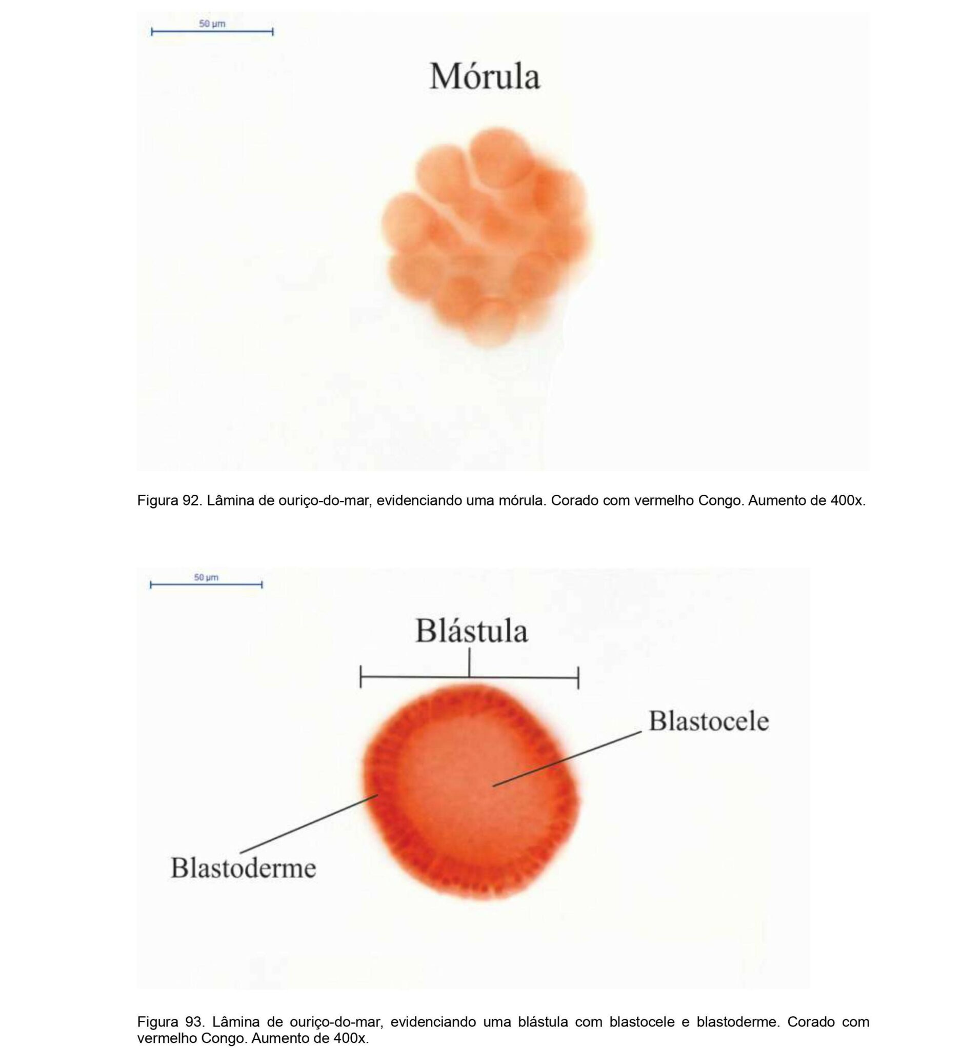 4. Desenvolvimento inicial do ouriço-do-mar – Embriologia Animal